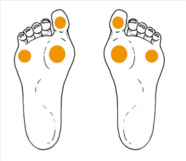 Figura 9. Sitios en los que se debeprobar la pérdida de la sensación ...